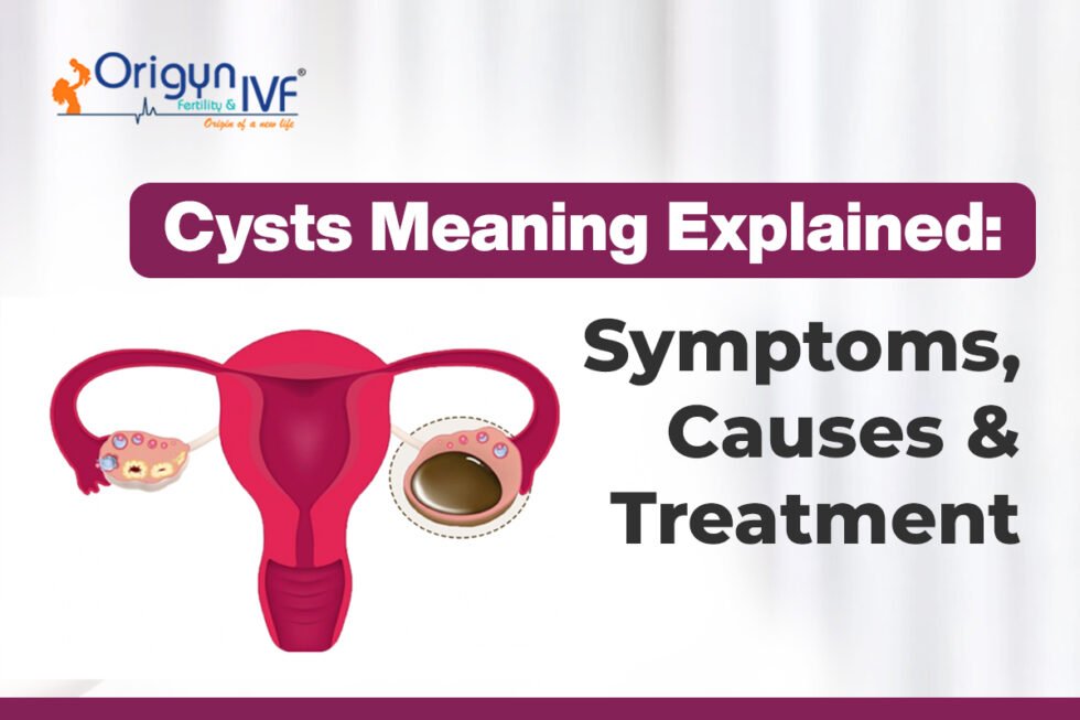 Cysts: Meaning, Symptoms, Causes and Treatment Options - origynivf.com
